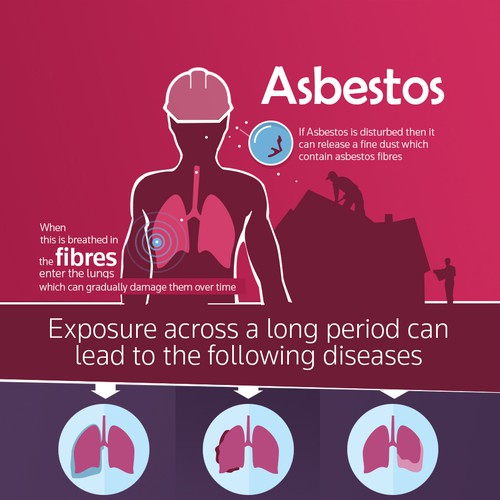 National Asbestos Helping -Symptoms of Asbestos Related Diseases: What ...